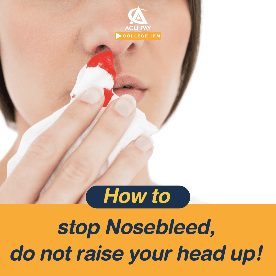 How to stop Nosebleed, do not raise your head up! - ACU Pay